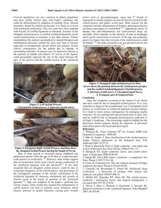 Eagle’s Syndrome; Unilateral Elongated Styloid Process: A rare case ...