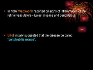 Eales’ Disease | PPT