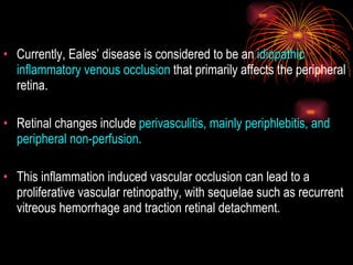 Eales’ Disease | PPT