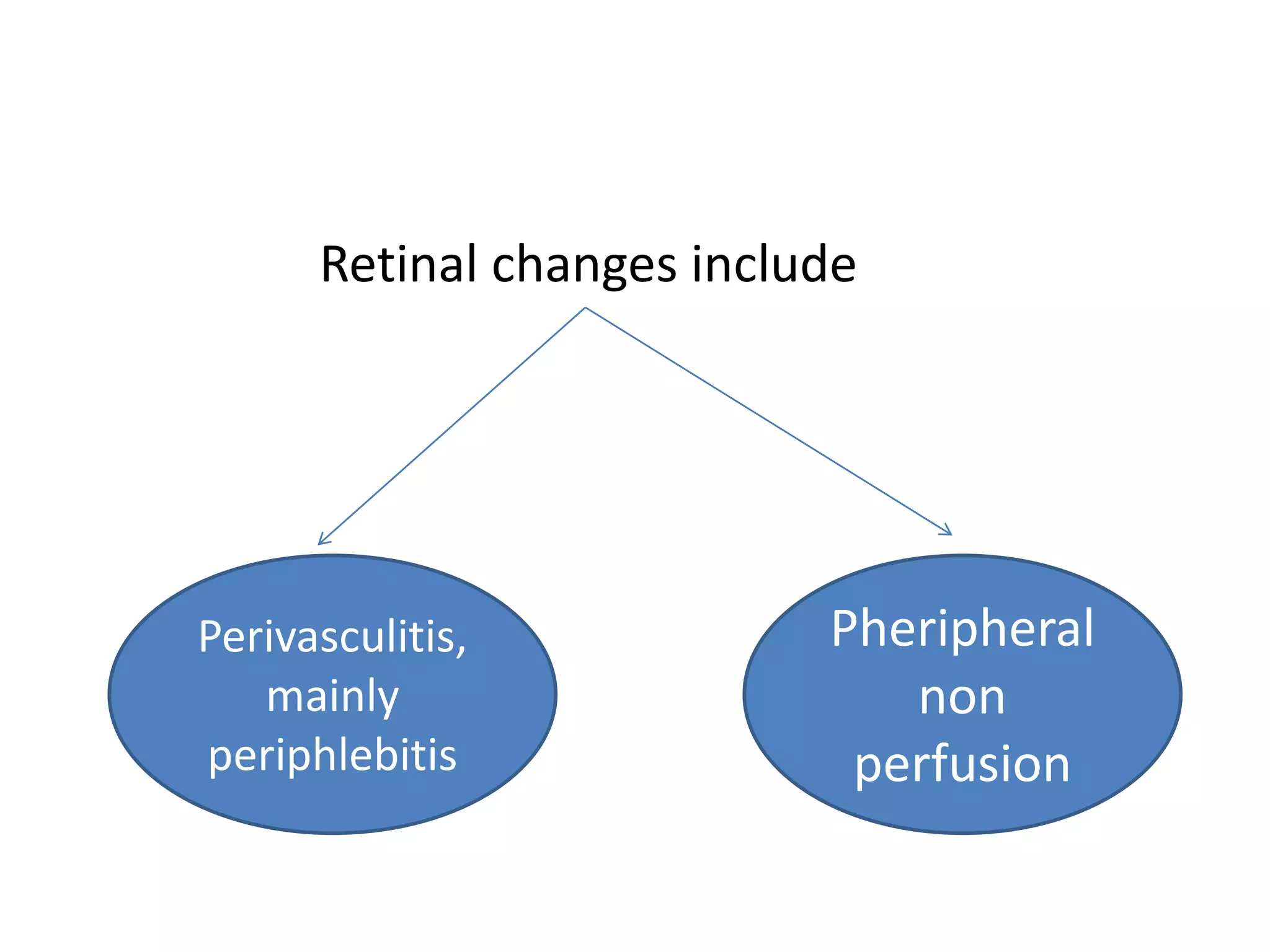 Eales disease | PPTX