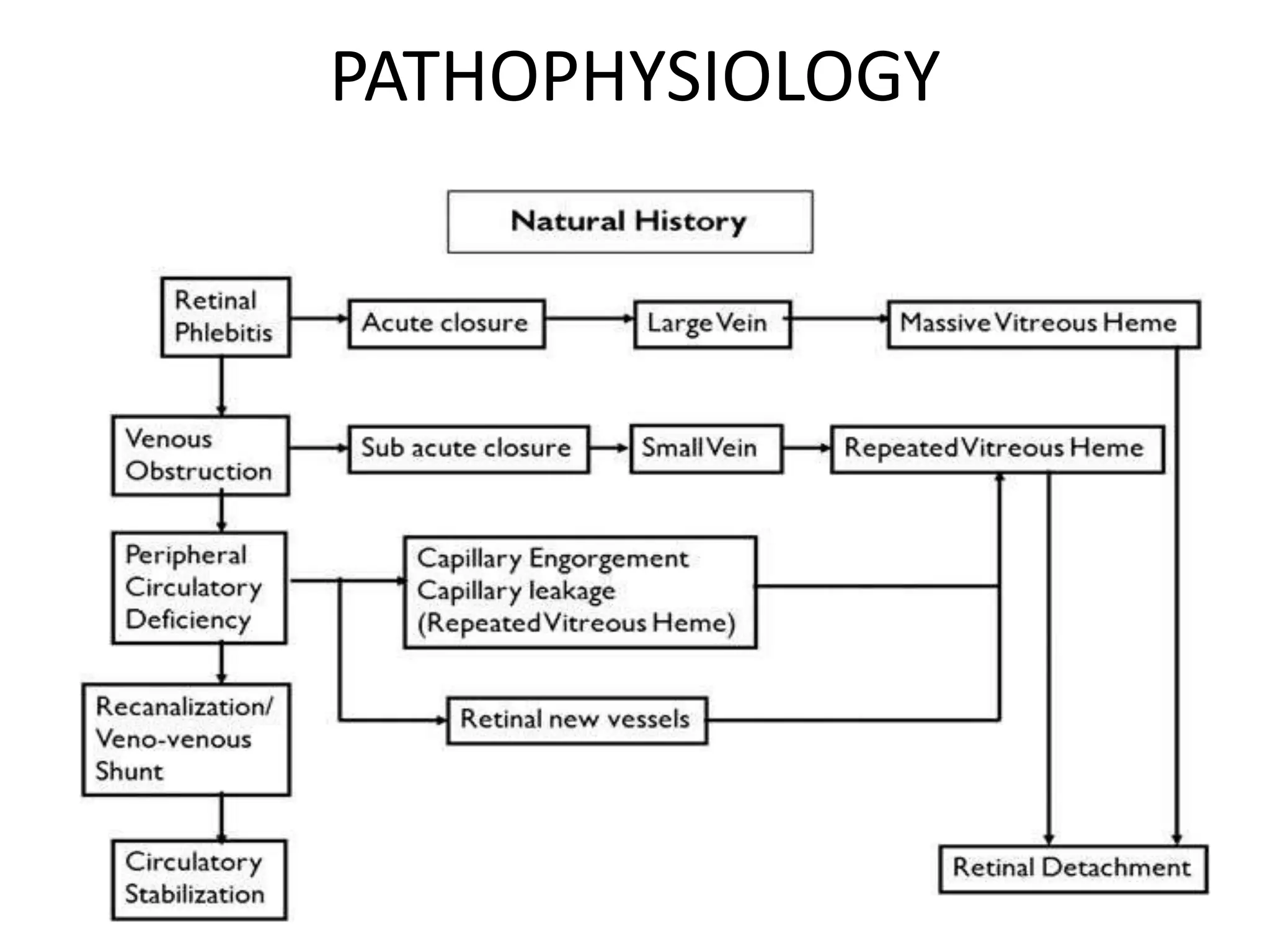Eales disease | PPTX