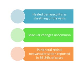 Eales disease | PPTX