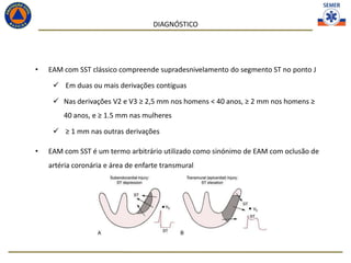 Enfarte Agudo do Miocárdio com Supra ST - Guidelines ESC 2017 | PDF