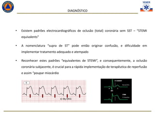 Enfarte Agudo do Miocárdio com Supra ST - Guidelines ESC 2017 | PDF
