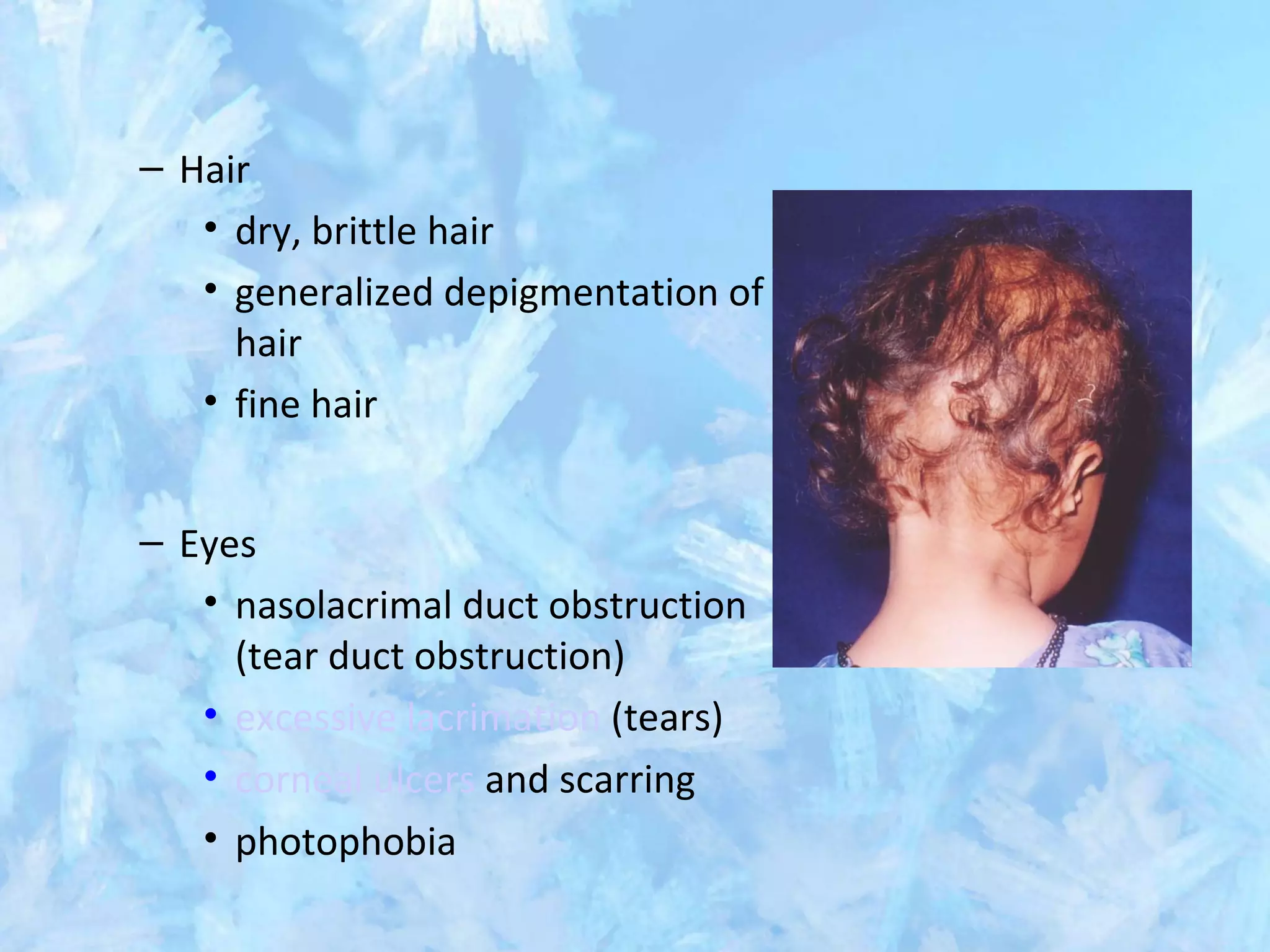 Student Work Ectrodactyly | PPT