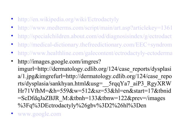 Student Work Ectrodactyly | PPT