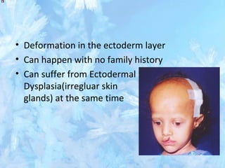 Student Work Ectrodactyly | PPT
