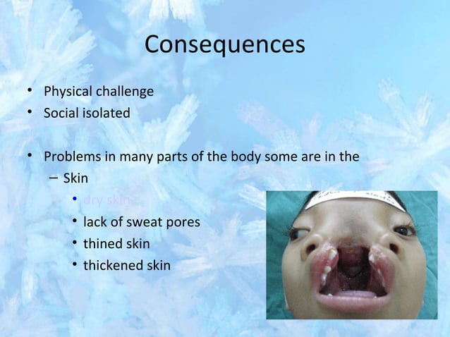 Student Work Ectrodactyly | PPT