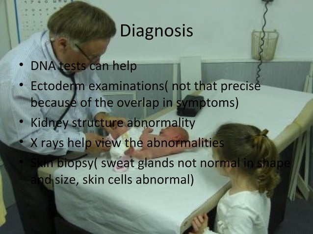 Student Work Ectrodactyly | PPT