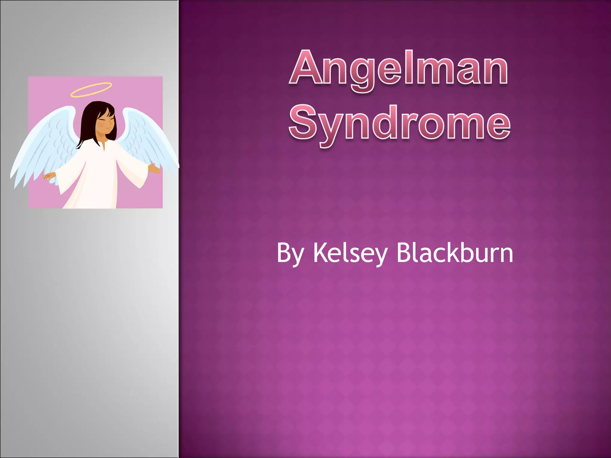 Angelman Syndrome: Kelsey Blackburn | PPT | Brain and Nervous System ...