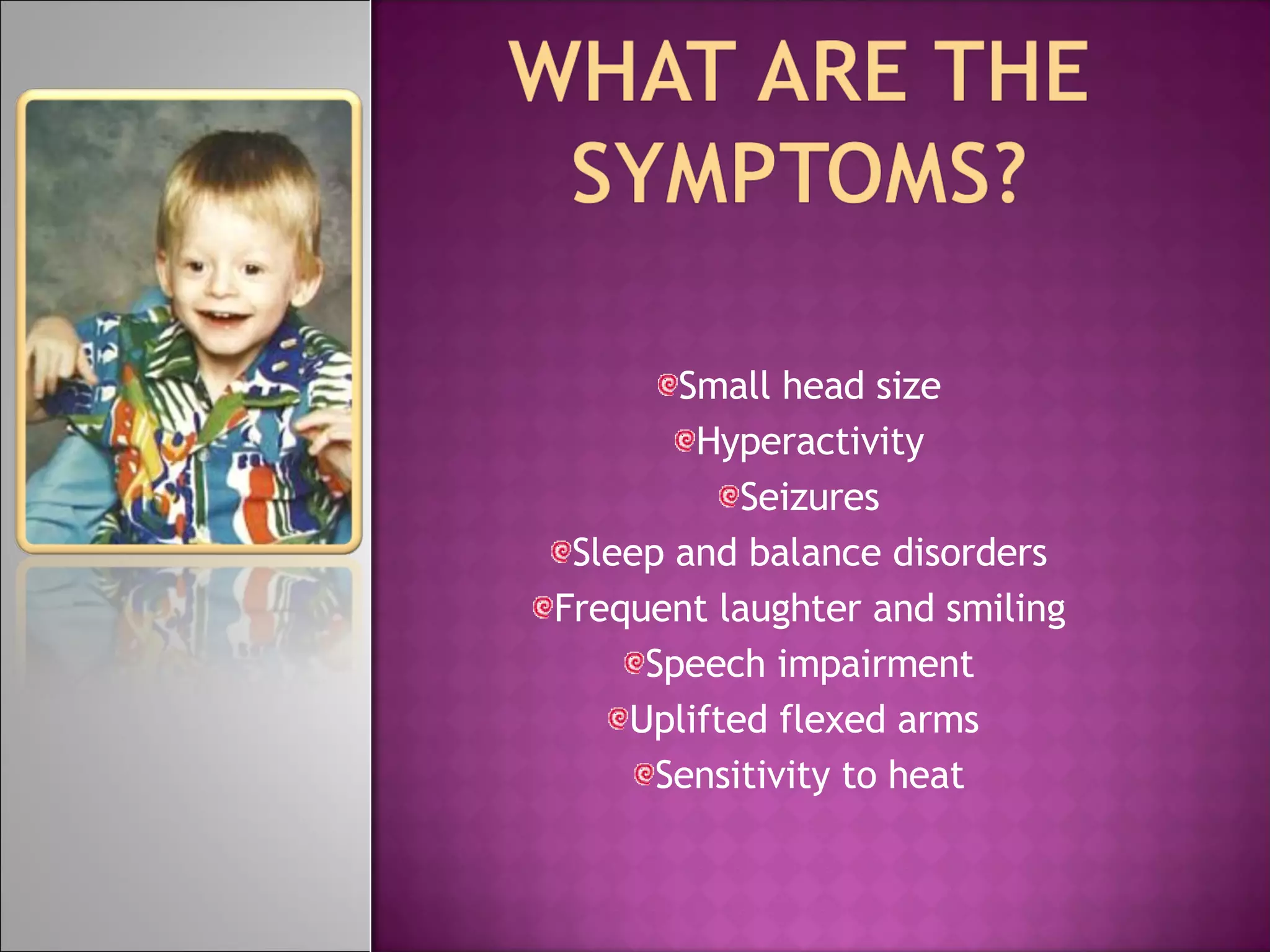 Angelman Syndrome: Kelsey Blackburn | PPT | Brain and Nervous System ...