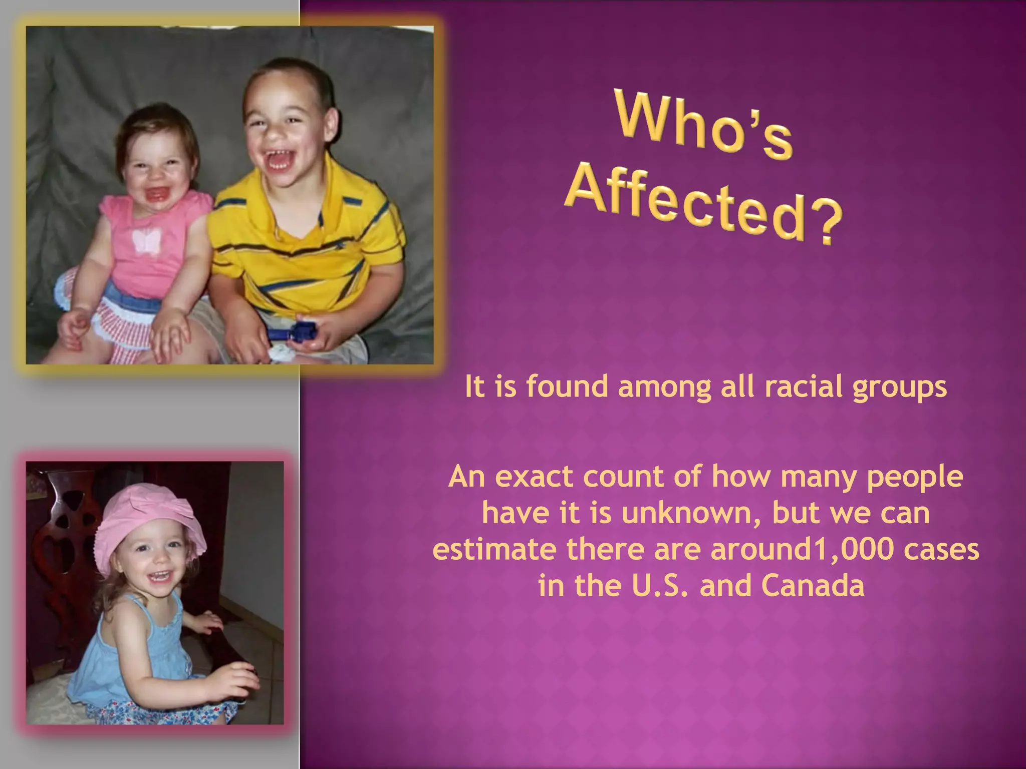 Angelman Syndrome: Kelsey Blackburn | PPT