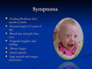 angelmansyndrome | PPT