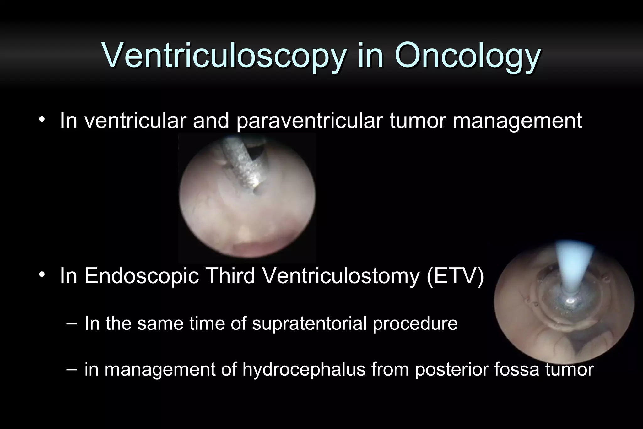The role of neuro endoscopy | PPT