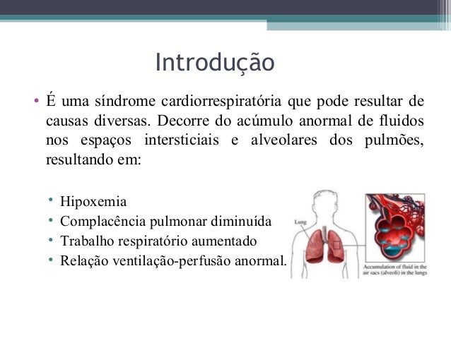 Edema Agudo de Pulmão