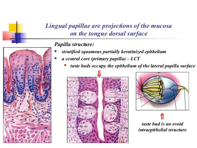 Vestibular Papillomatosis Tongue