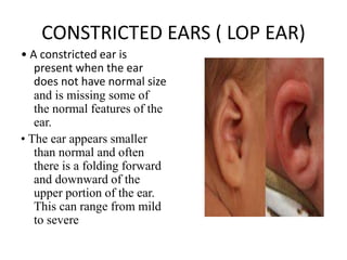 Ear | PPTX