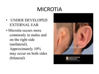 Ear | PPTX
