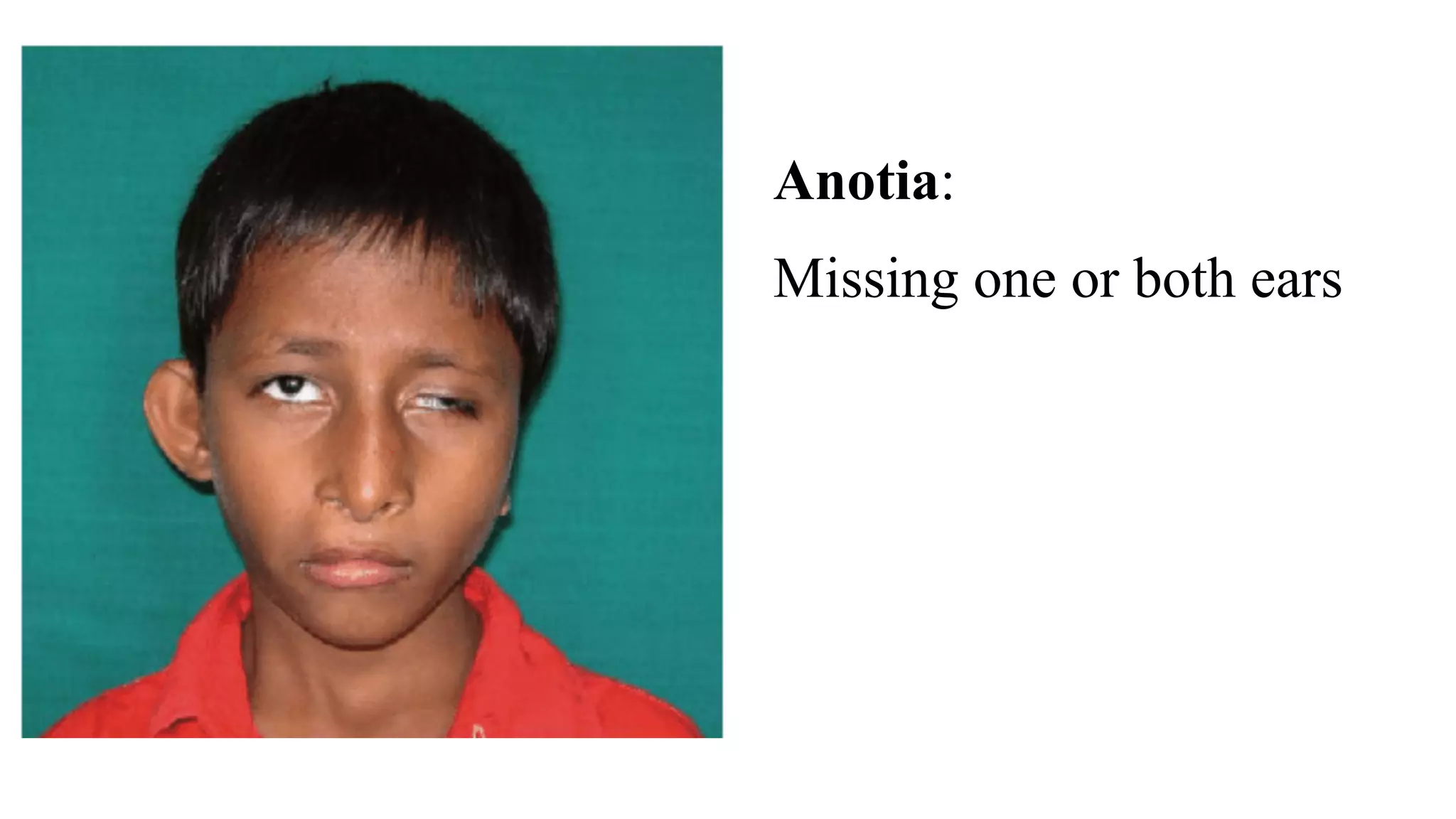 EAR ASSESSMENT | PDF