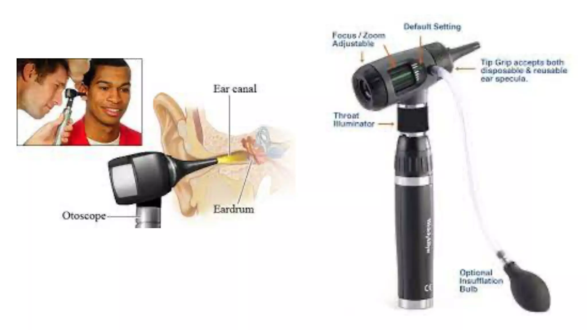 EAR ASSESSMENT | PDF