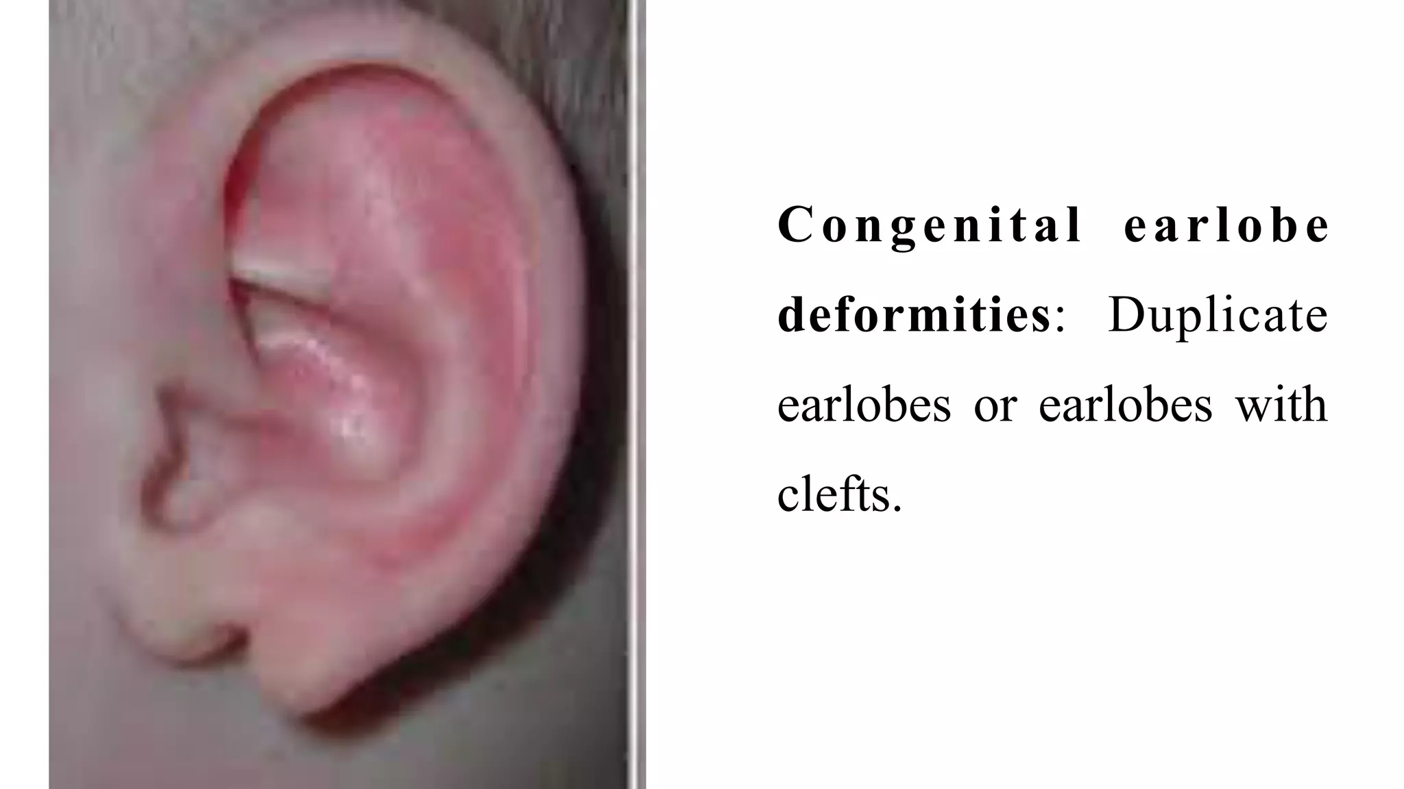 EAR ASSESSMENT | PDF