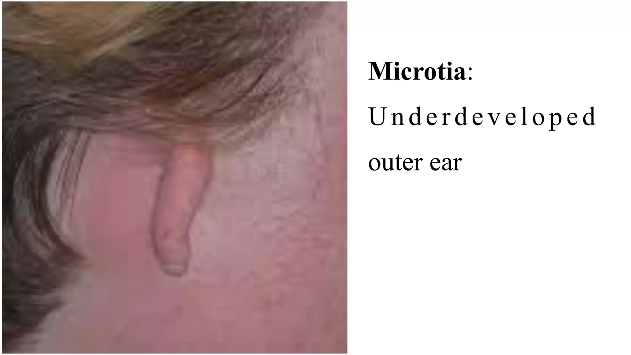 EAR ASSESSMENT | PDF