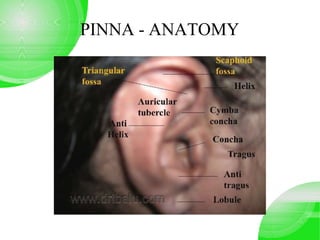 Ear Ache, persentation and management.pptx
