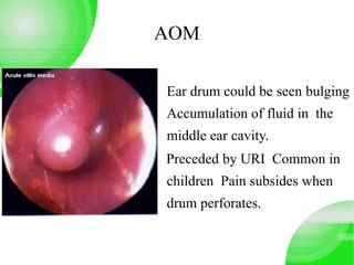 Ear Ache and Otalgia management for patients.pptx