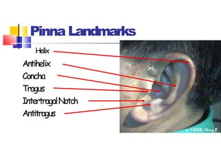 Ear Anatomy & Physiology | PPT