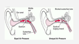 Ear barotrauma causes, symptoms and treatment