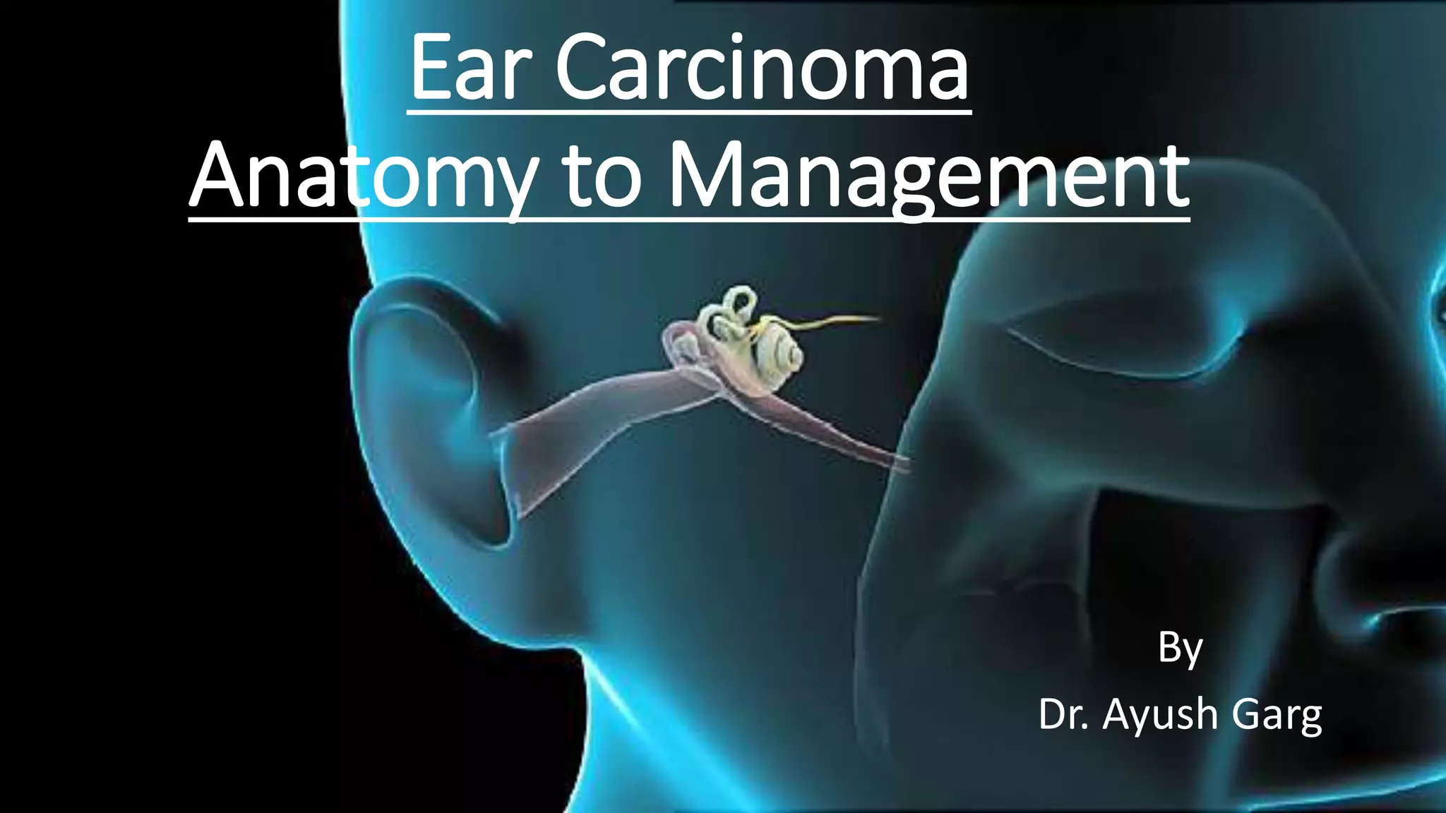 Ear carcinoma | PPTX