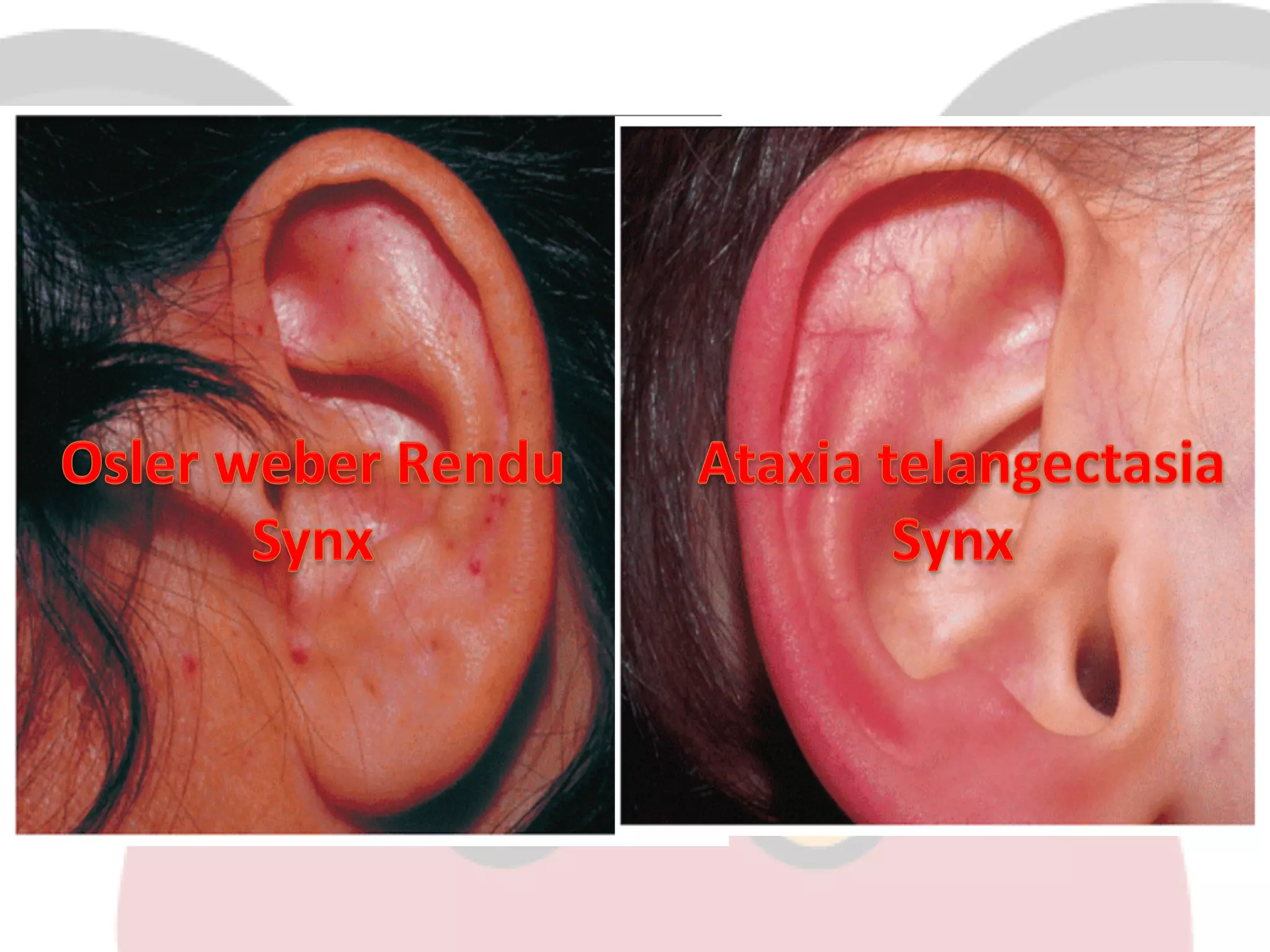 Ear Dermatosis - Dr Maryam K Alnajem | PPT