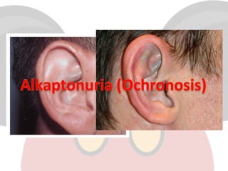 Ochronosis Ear