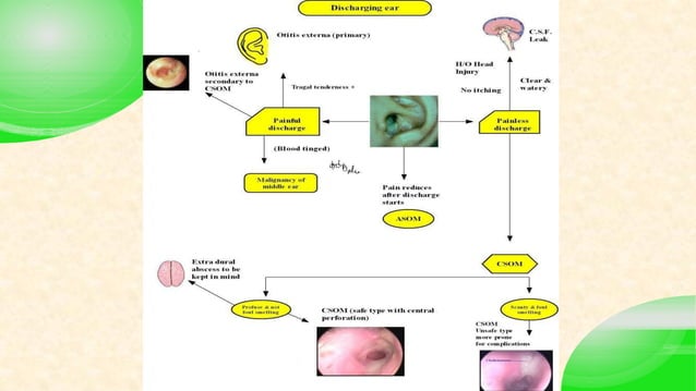 Management of Ear Discharge and otorrhoea.pptx