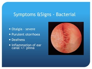 Ear disease presentation (manchester g ps) | PPTX
