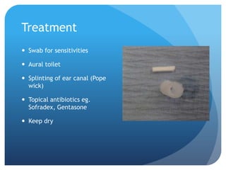 Ear disease presentation (manchester g ps) | PPTX