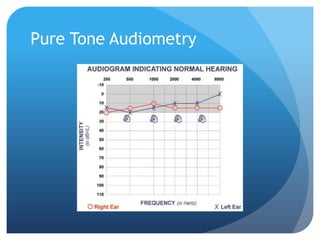 Ear disease presentation (manchester g ps) | PPTX