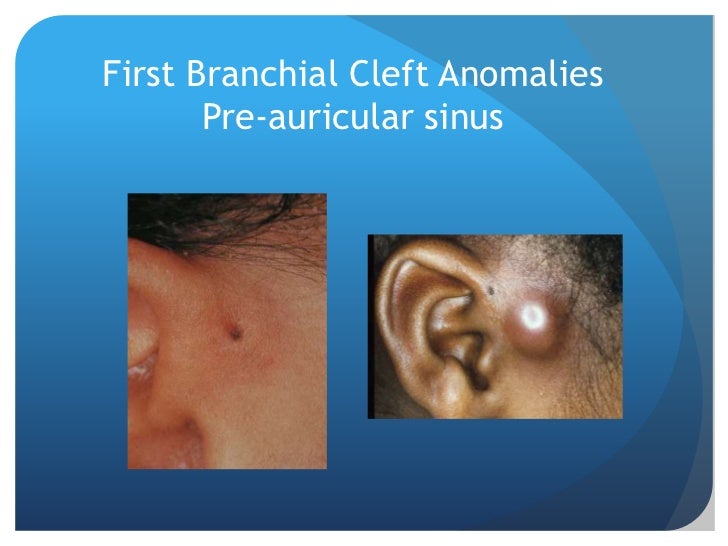 Ear disease presentation (manchester g ps)