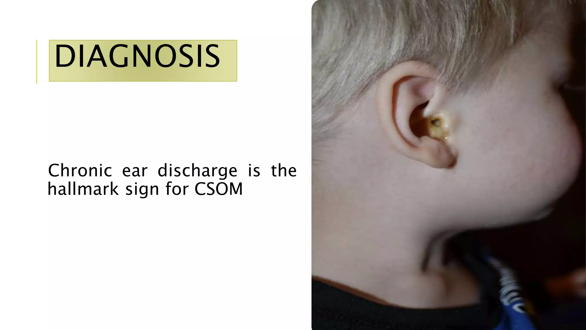 ear disorder.pptx