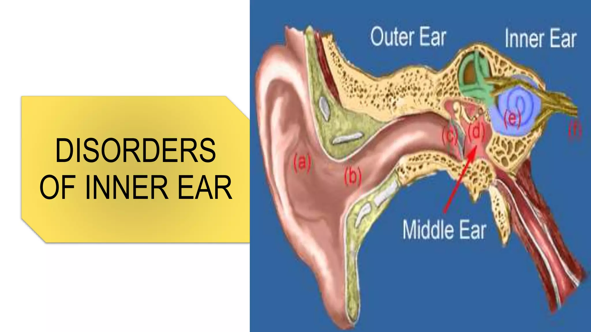 ear disorder.pptx