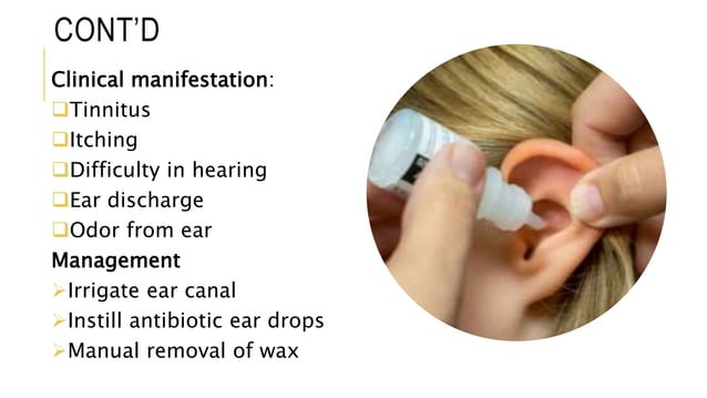 ear disorder.pptx