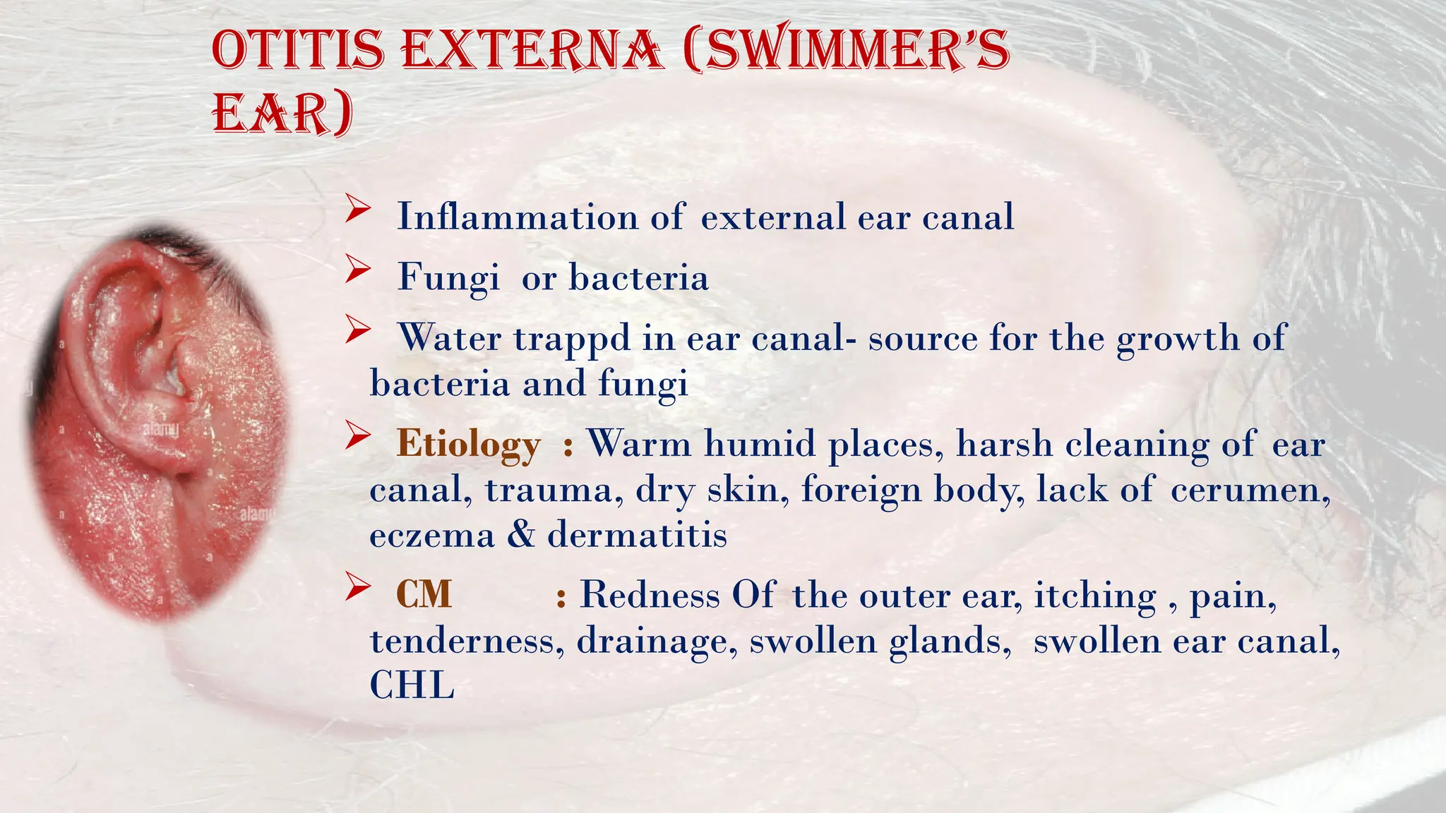 EAR DISORDERS nursing notes important-2.pptx