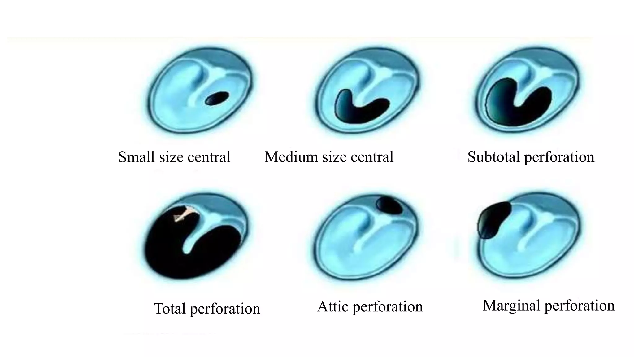 ear examination.pptx