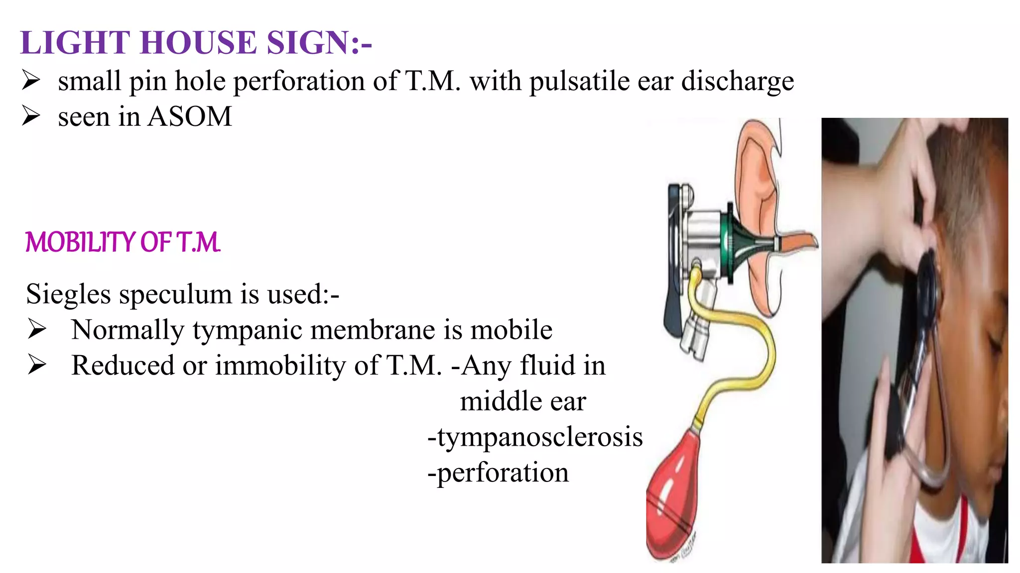 ear examination.pptx