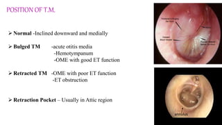ear examination.pptx