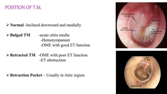 ear examination.pptx