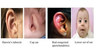 ear examination.pptx
