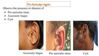 ear examination.pptx