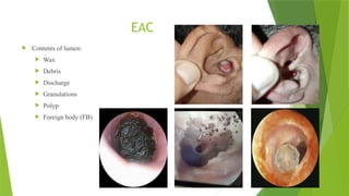 Physical examination of ear | PPTX