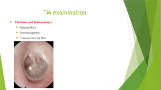 Physical examination of ear | PPTX